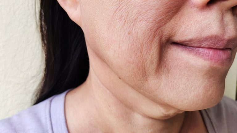 Cómo combatir la flacidez facial | Sisneo Bioscience